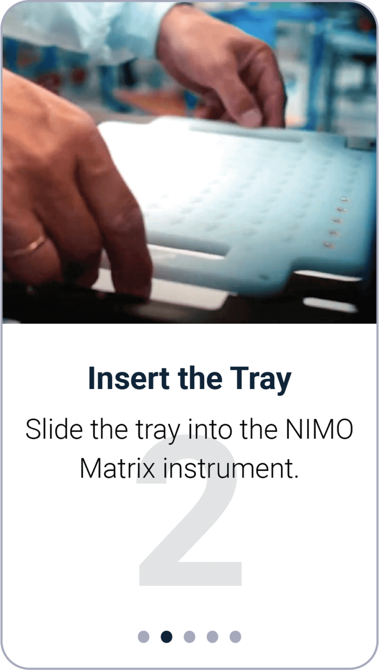 NIMO Matrix - Lambda-X Ophthalmics